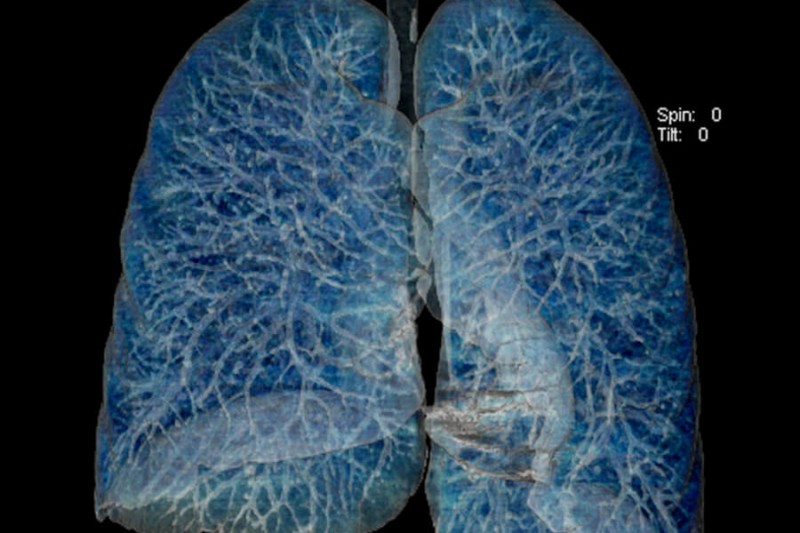 Por que e onde usar o contraste iodado? - Tesla Imagem